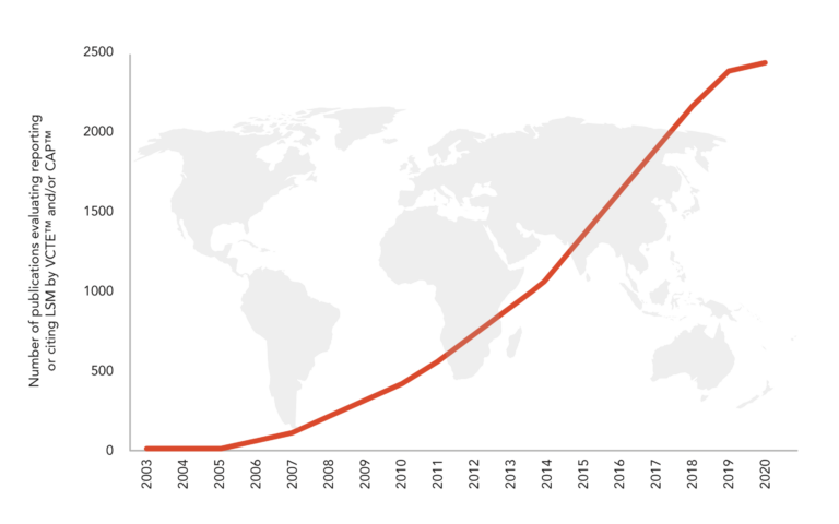 FibroScan®, transient elastography for liver stiffness - ECHOSENS
