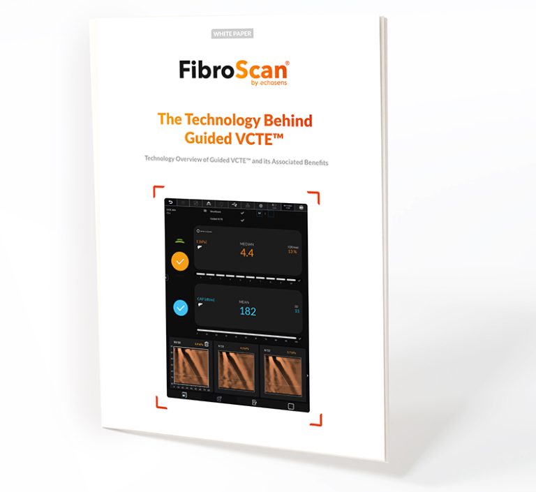 Guided VCTE™ - Echosens