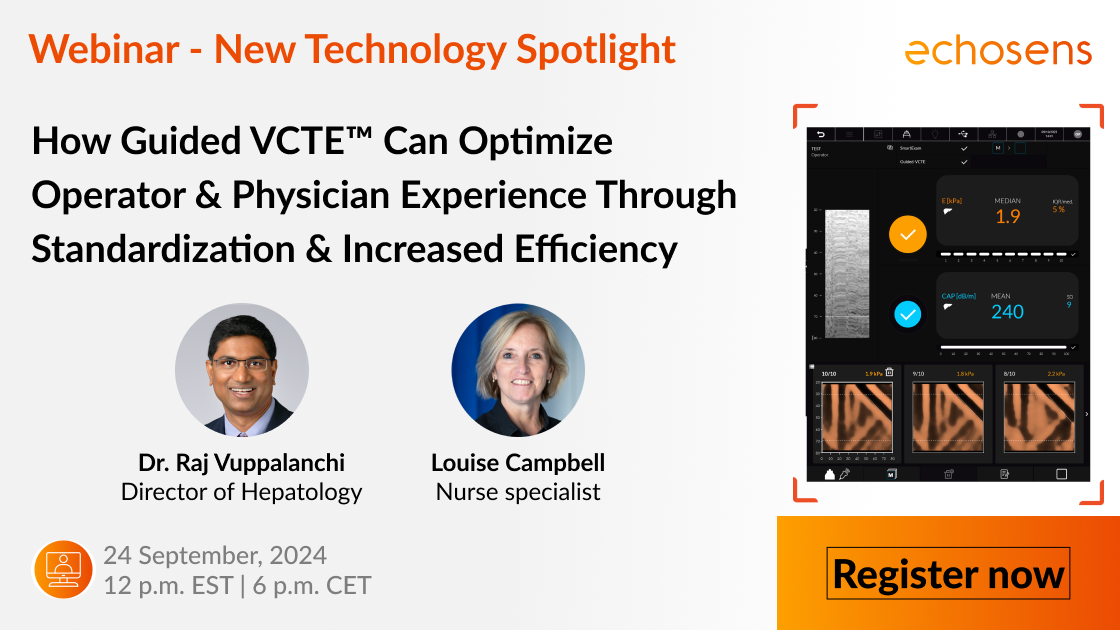 How Guided VCTE™ Can Optimize Operator and Physician Experience