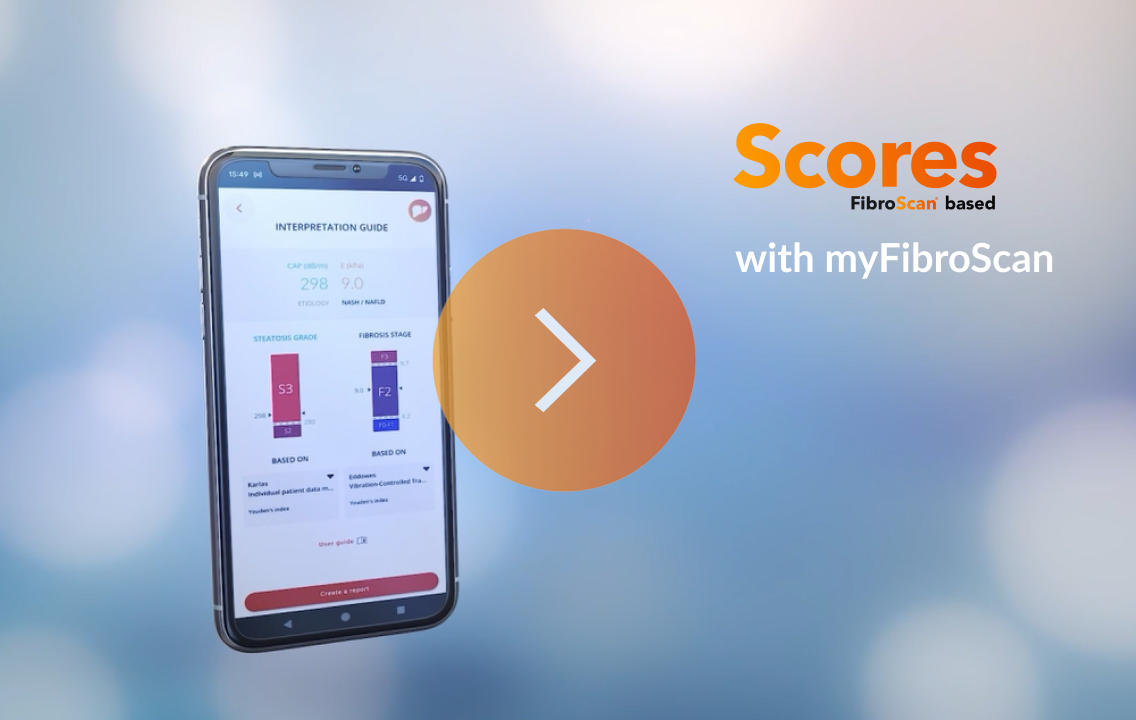 myFibroScan per interpretare i risultati del FibroScan® dei pazient ...