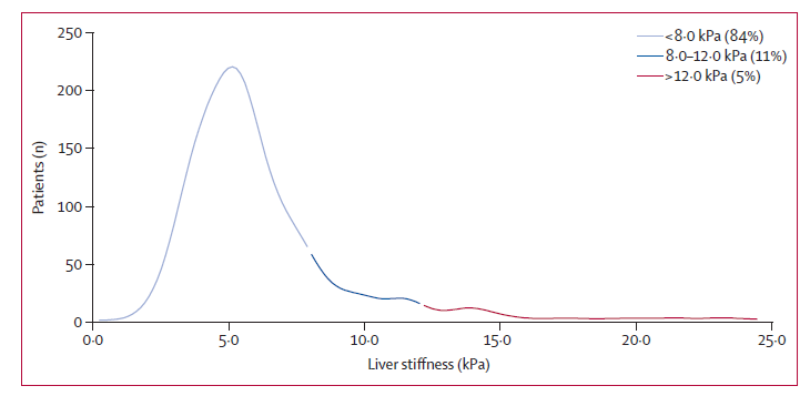 Screening for advanced liver fibrosis due to MALSD alongside retina ...